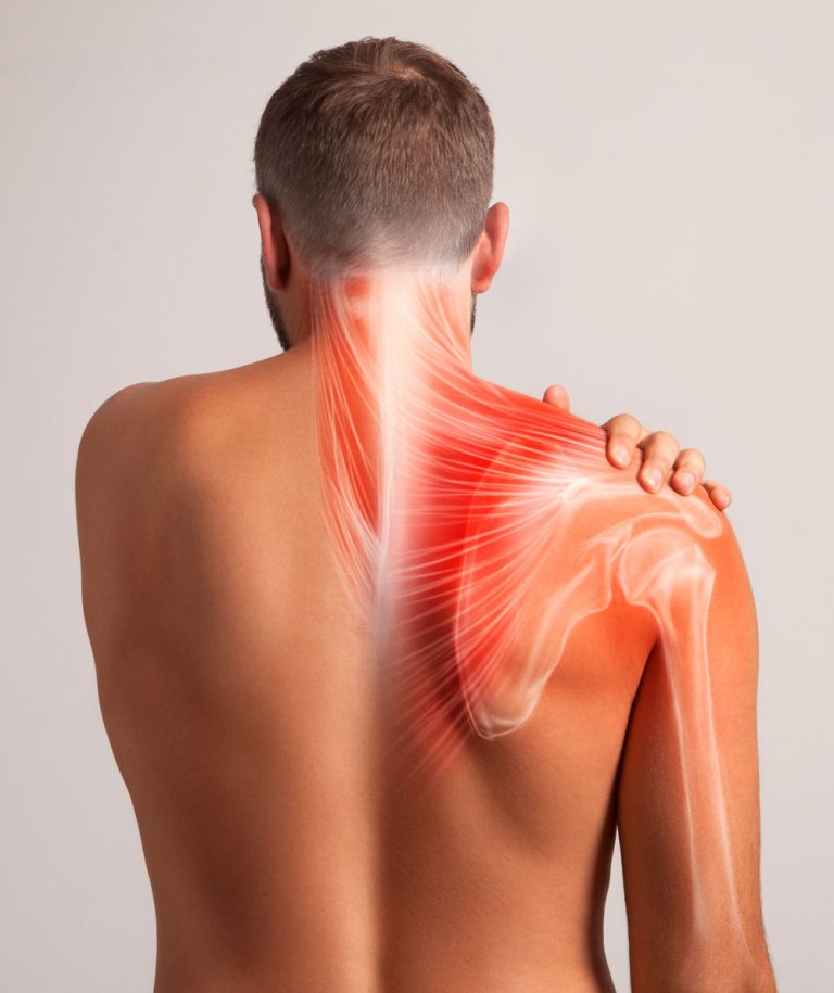 Neck and Shoulder Pain – Matrix Therapy : Matrix Health Solutions